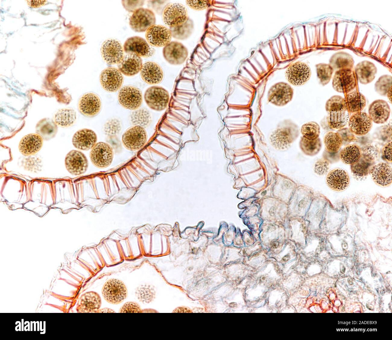 Section through flower anthers, light micrograph. Anthers are the male ...