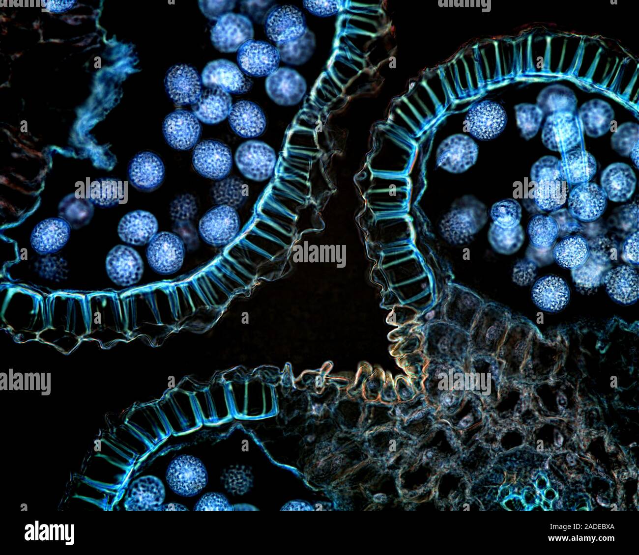 Section through flower anthers, light micrograph. Anthers are the male ...