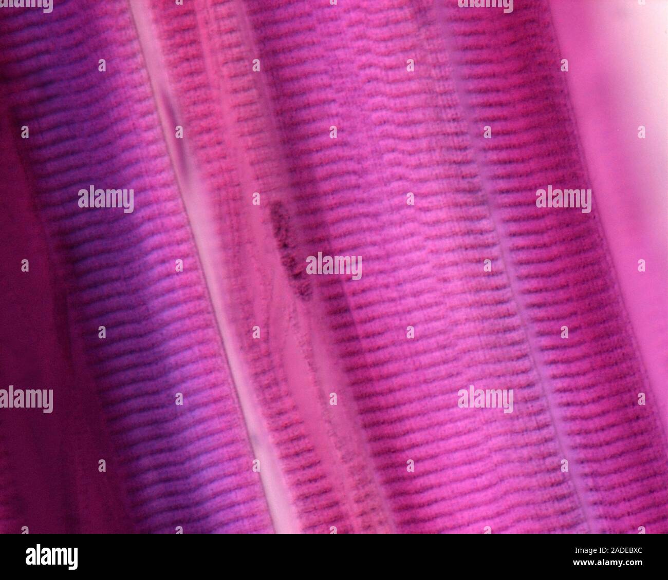 Skeletal muscle fibres. Light micrograph of a longitudinal section ...