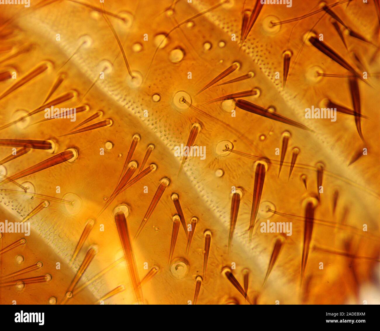 Cockroach exoskeleton bristles, light micrograph. The bristles on an ...