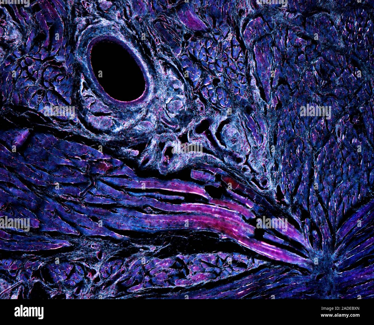Muscle tissue and blood vessel, light micrograph. The lumen of the ...