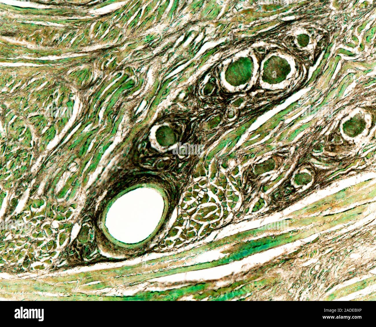 Muscle tissue and blood vessels, light micrograph. The lumen of the ...