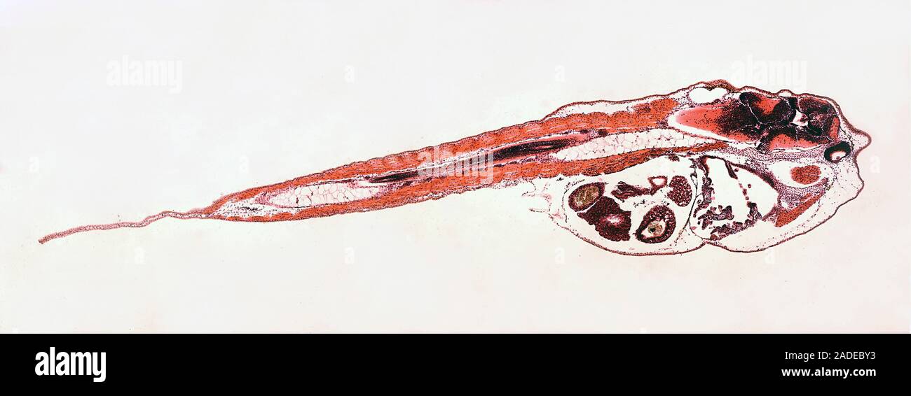 Fish embryo. Light micrograph of a longitudinal section through the ...