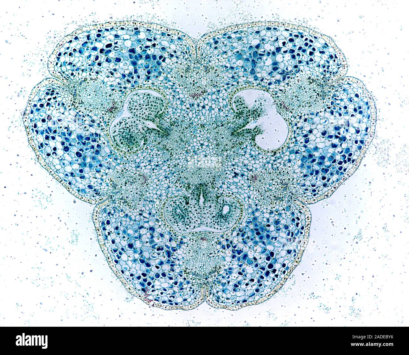 Section through flower anther, light micrograph. Anthers are the male ...