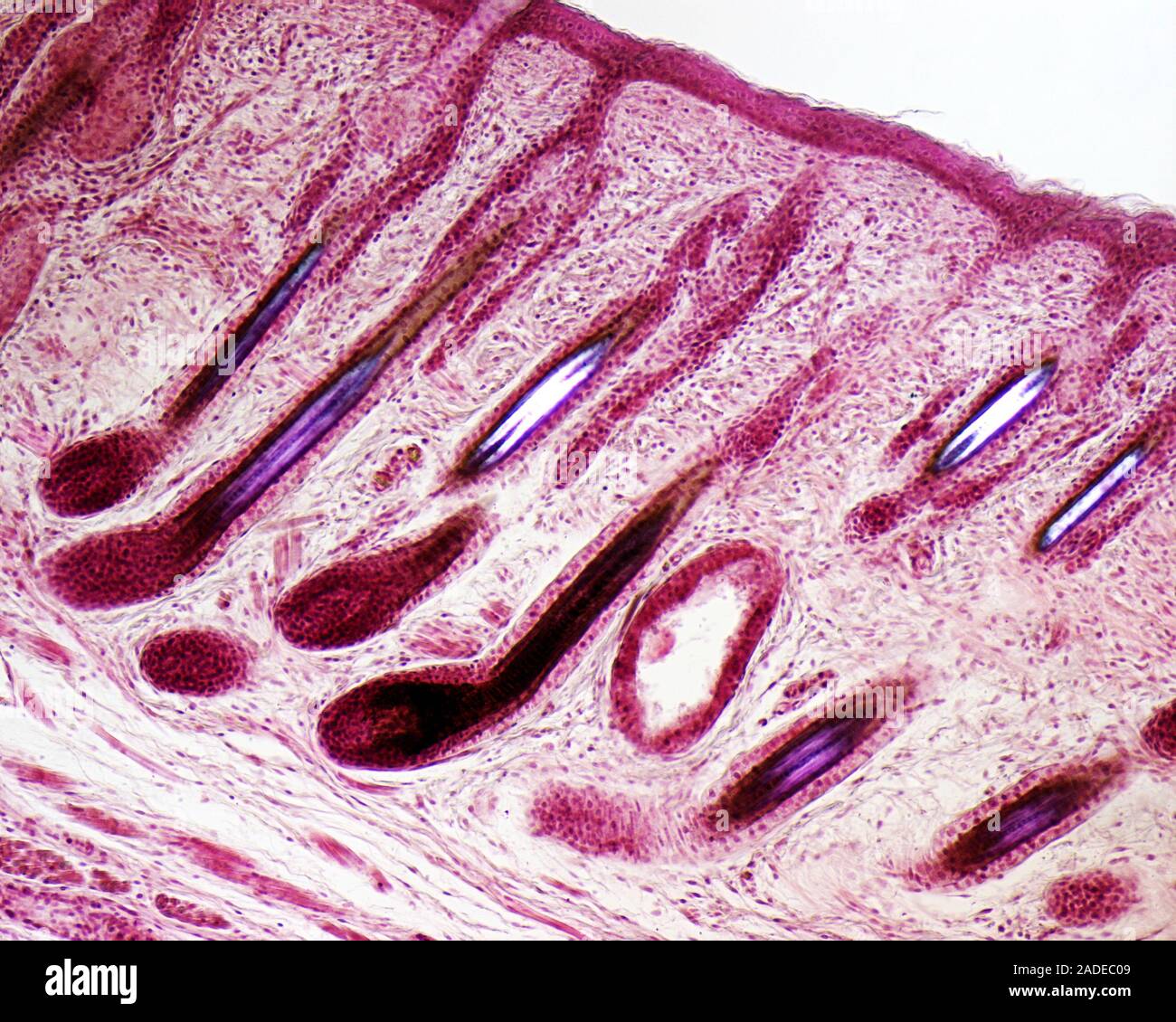 Skin tissue and hair follicles. Light micrograph of a section through ...