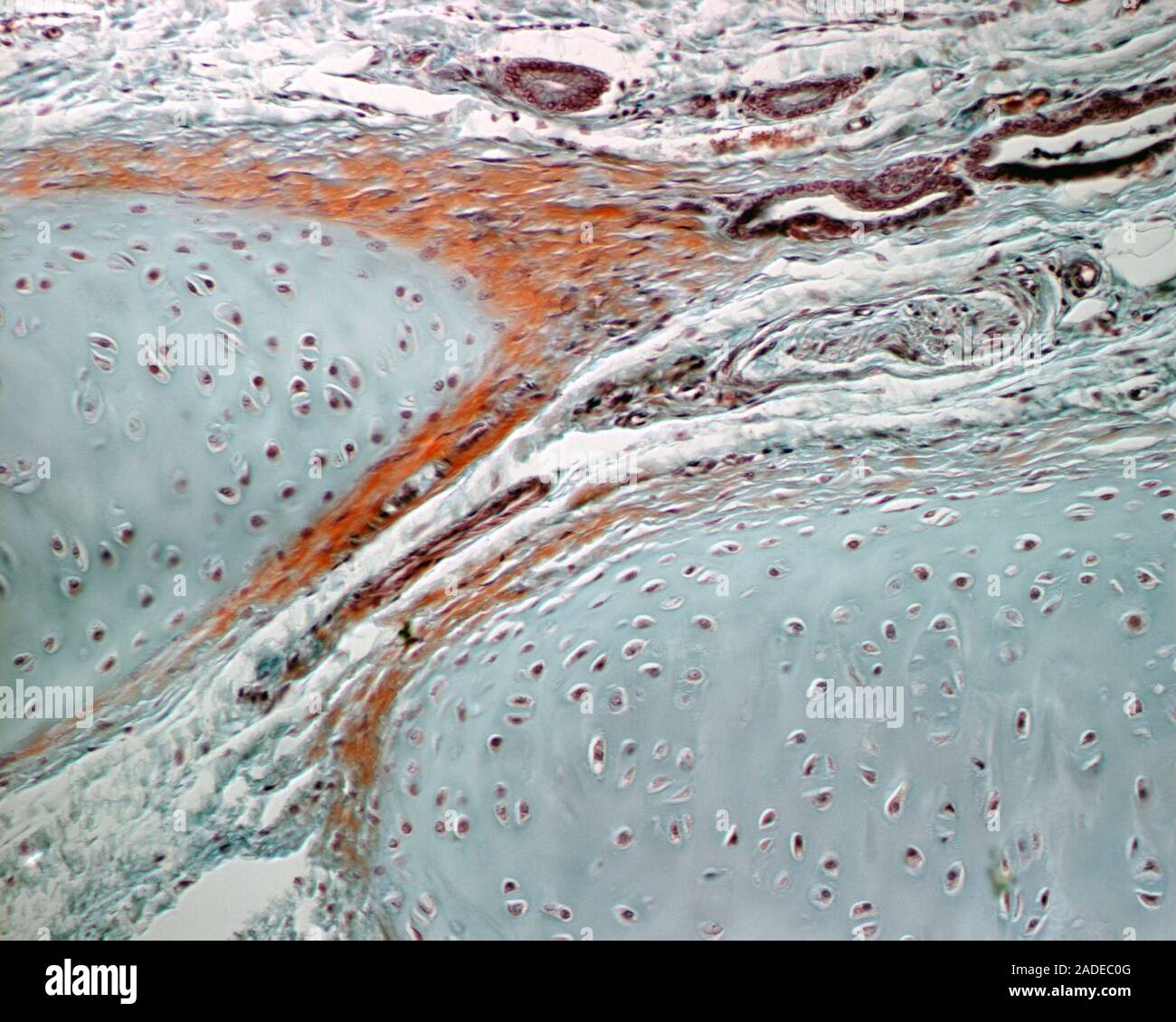 Hyaline cartilage. Light micrograph of a section through hyaline ...