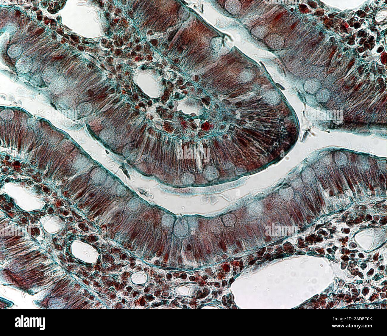 Small intestine tissue, light micrograph. Section through folds of ...