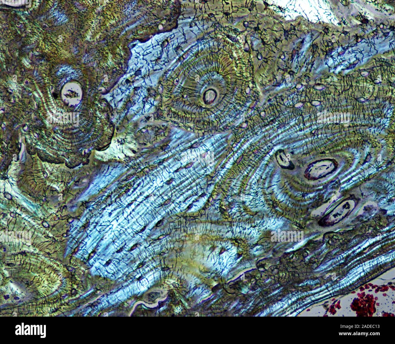 Compact bone, light micrograph. Bone is a dense matrix of calcium ...