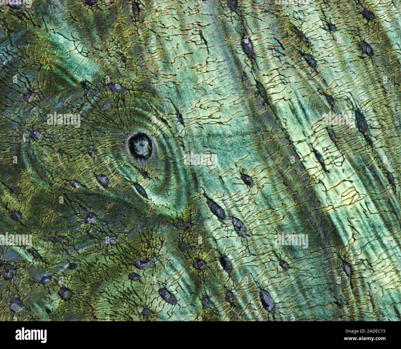 Compact bone, light micrograph. Bone is a dense matrix of calcium ...