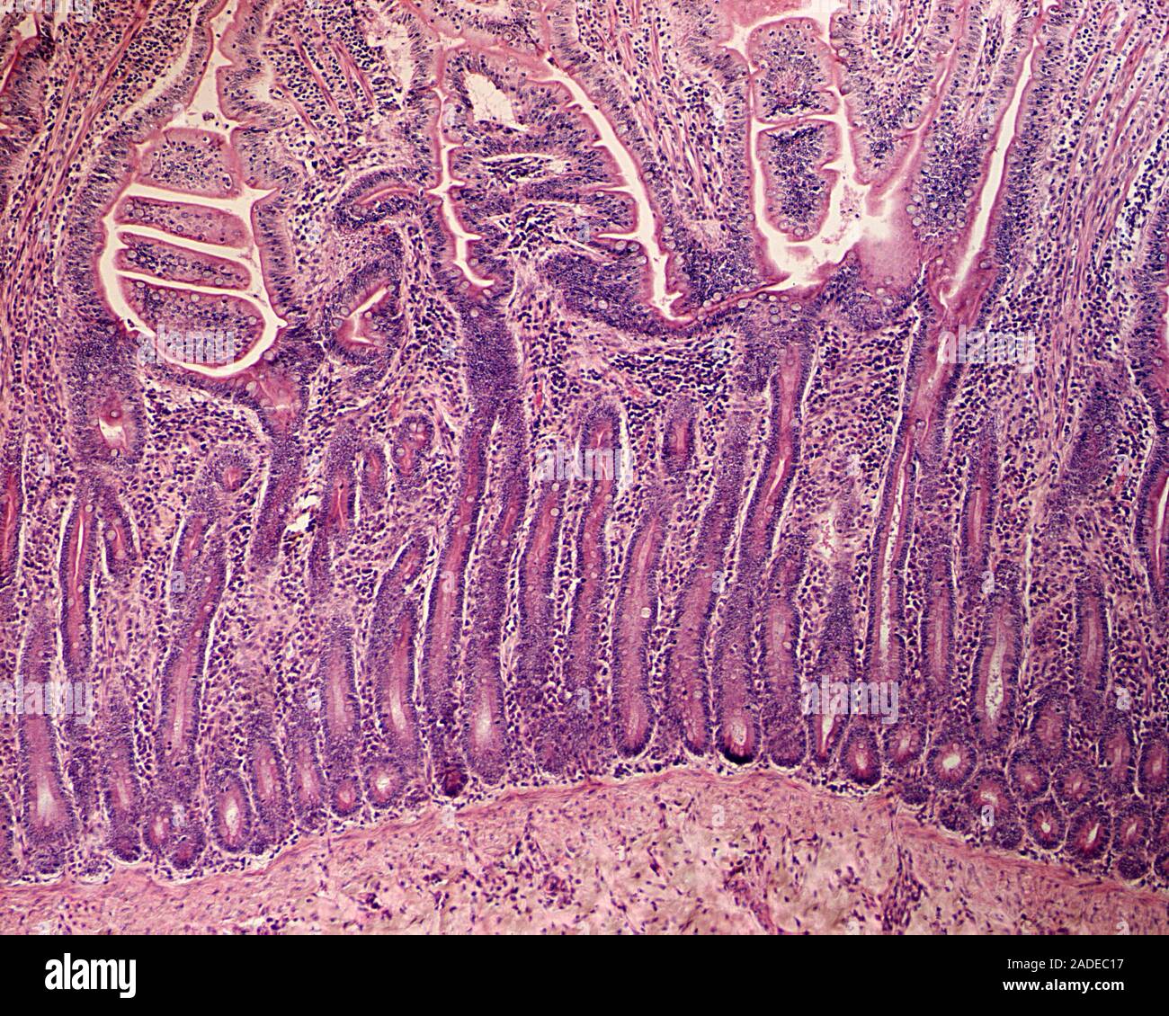 Small intestine tissue, light micrograph. Section through folds (villi ...