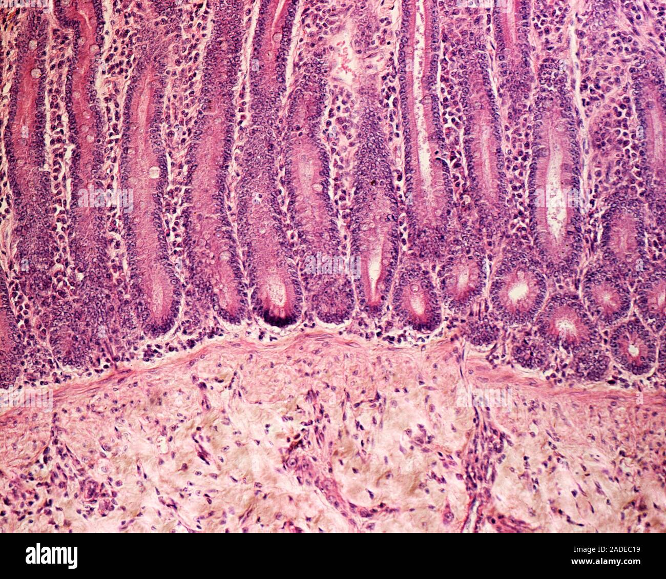 Small intestine tissue, light micrograph. Section through folds (villi ...