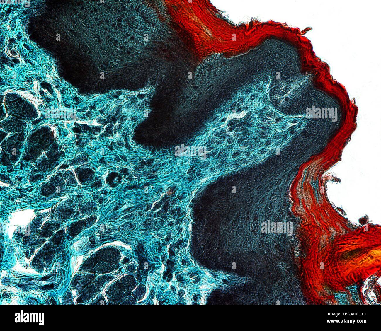 Tongue tissue, light micrograph. Section through the surface of the ...