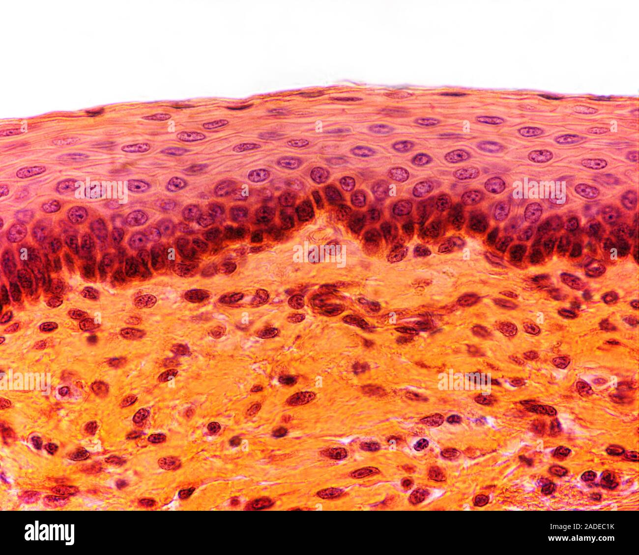 Dog skin, light micrograph. At top is the outer layer, the epidermis ...