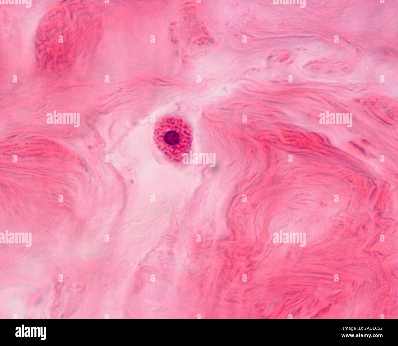 Mast cell, light micrograph. The mast cell, or mastocyte, is a ...