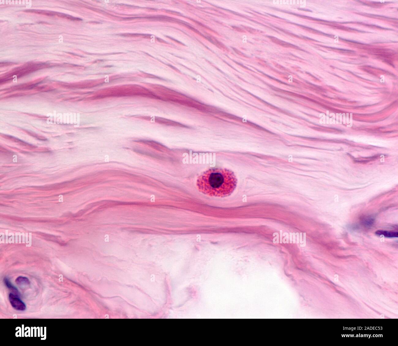Mast cell, light micrograph. The mast cell, or mastocyte, is a ...