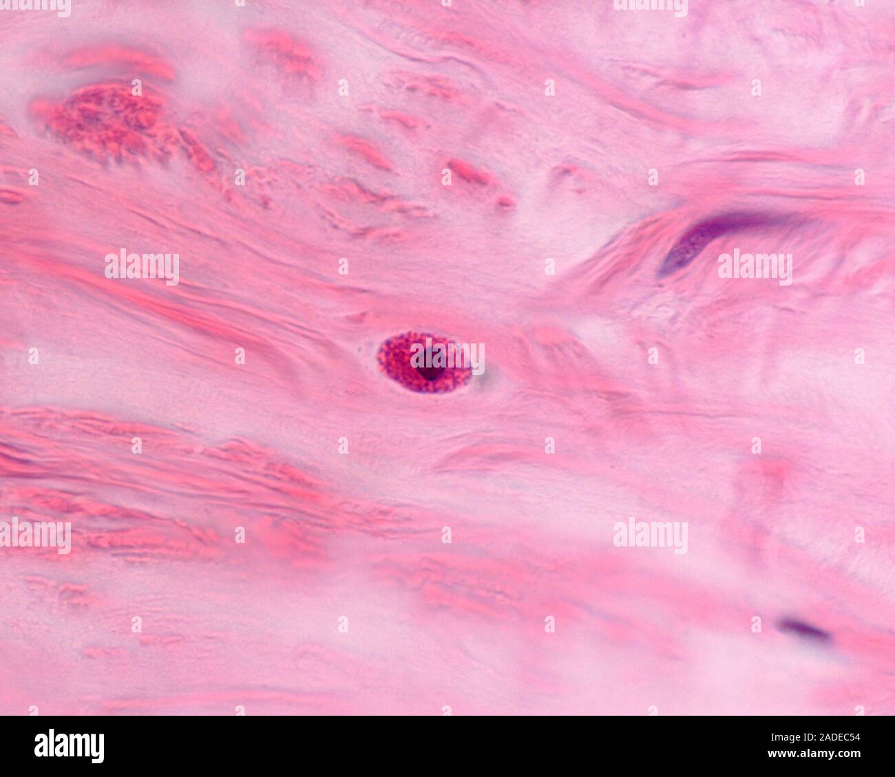 Mast cell, light micrograph. The mast cell, or mastocyte, is a ...