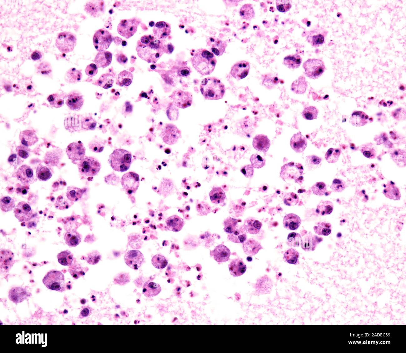 Light micrograph of apoptotic bodies coming from apoptosis of granulosa ...