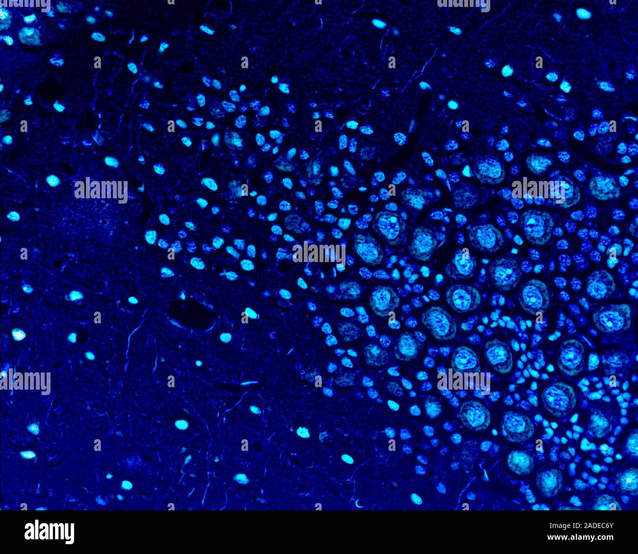 Cerebellum brain cells, light micrograph. This sample has been prepared ...