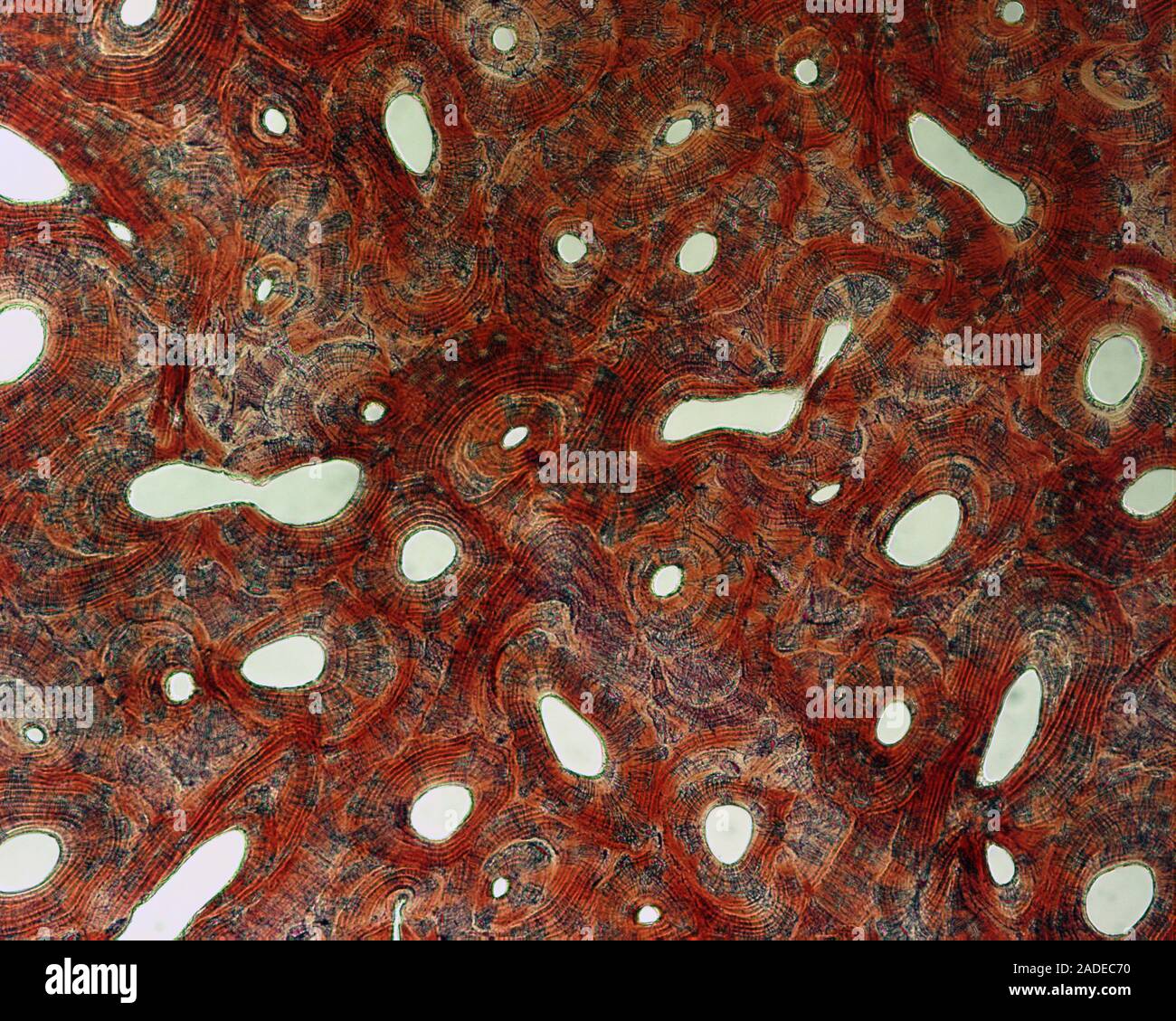 Compact bone, light micrograph. Bone is a dense matrix of calcium ...