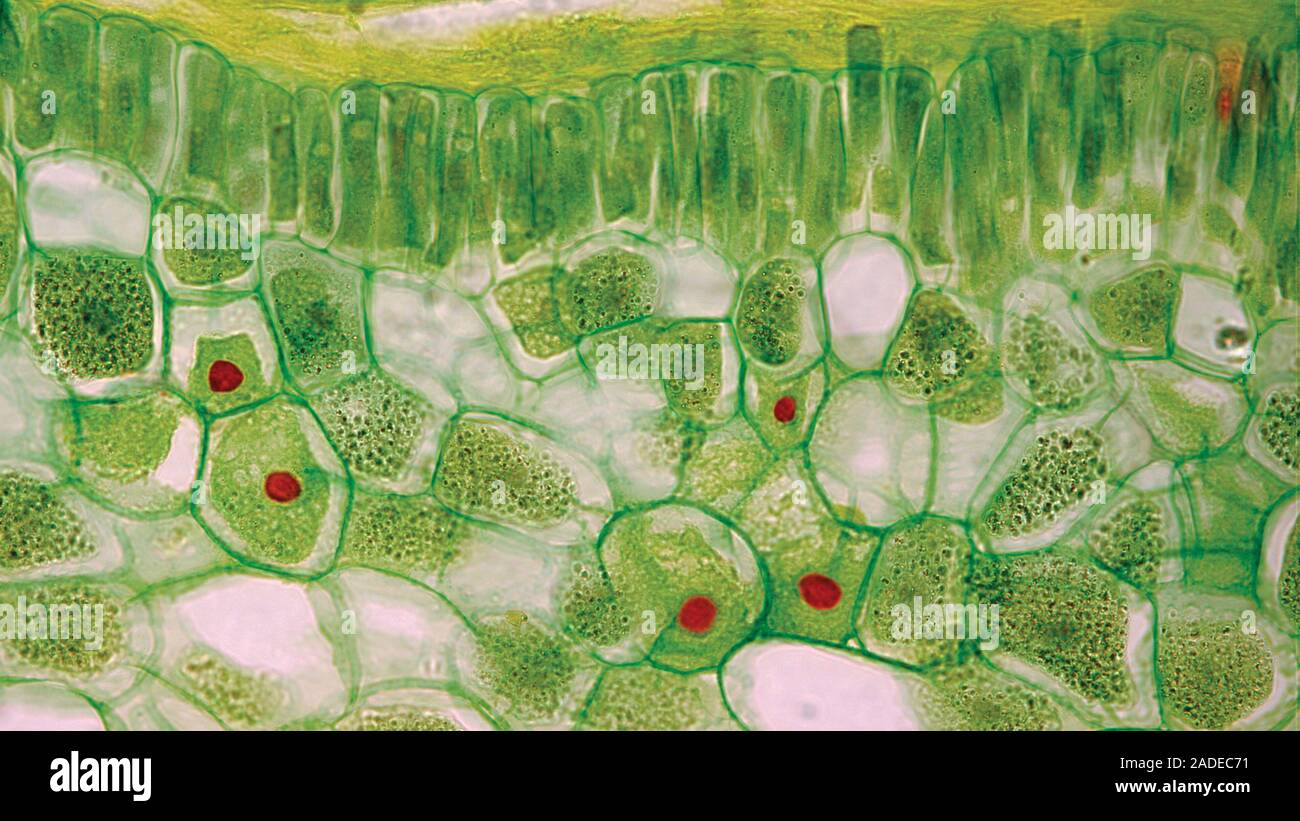 Leaf sponge cells, light micrograph. Section through the sponge cell ...