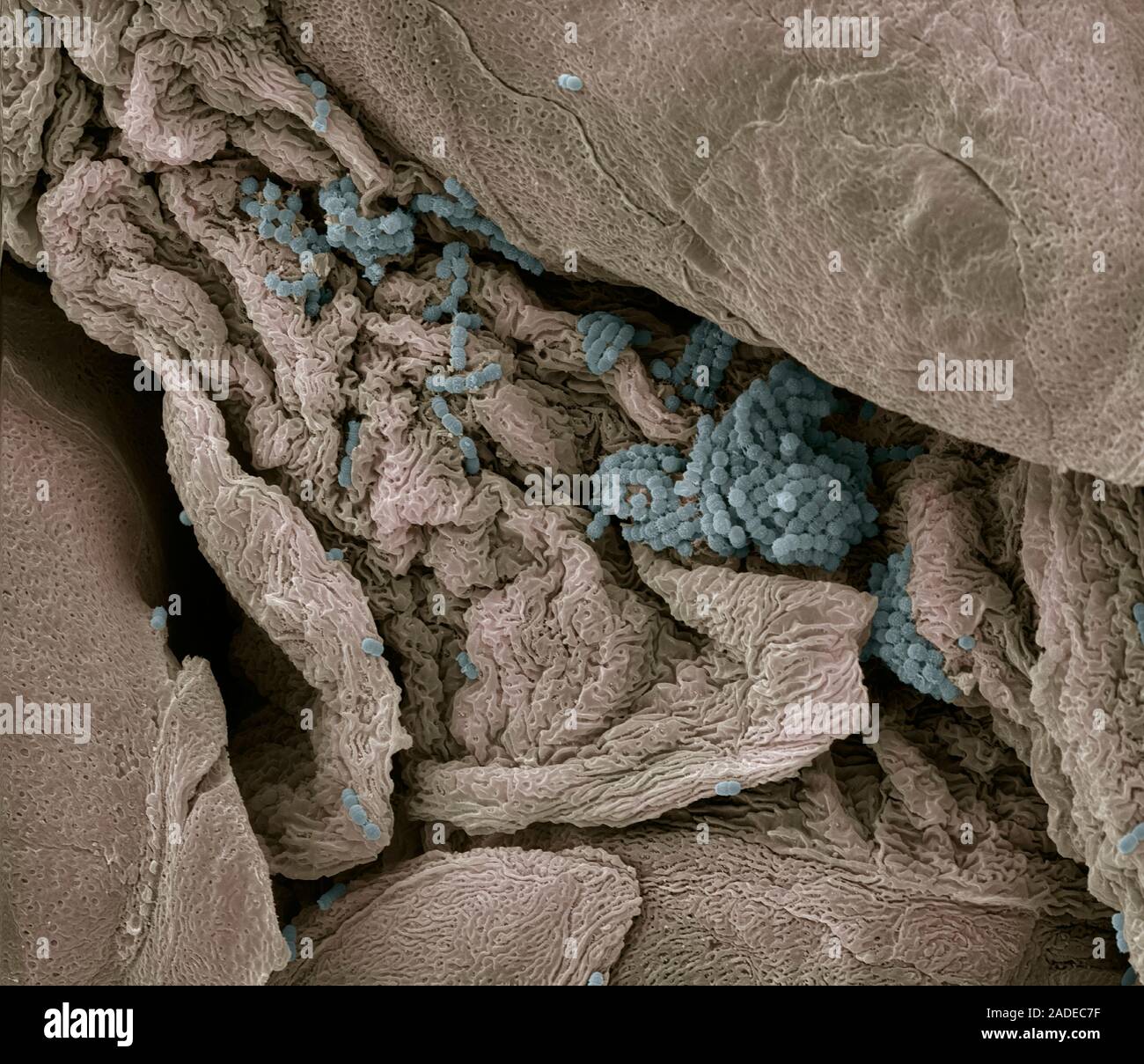 Bacteria on tongue. Coloured scanning electron micrograph (SEM) of part ...