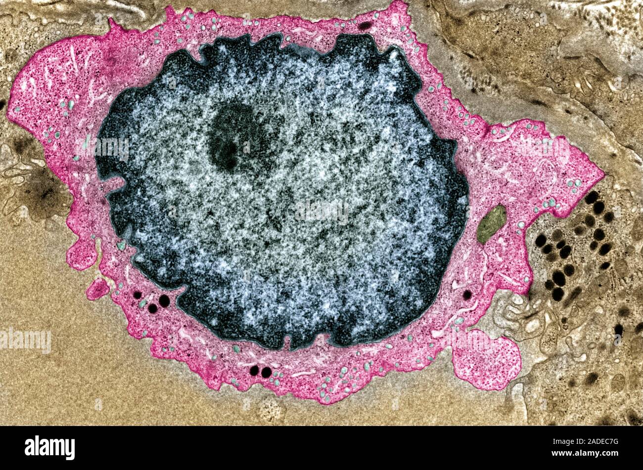 Cell from skeletal muscle, coloured transmission electron micrograph ...