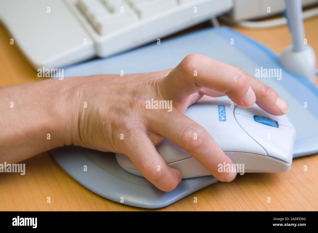 Woman With Disability At Work Using A Computer Mouse Nottinghamshire Coalition For Disabled