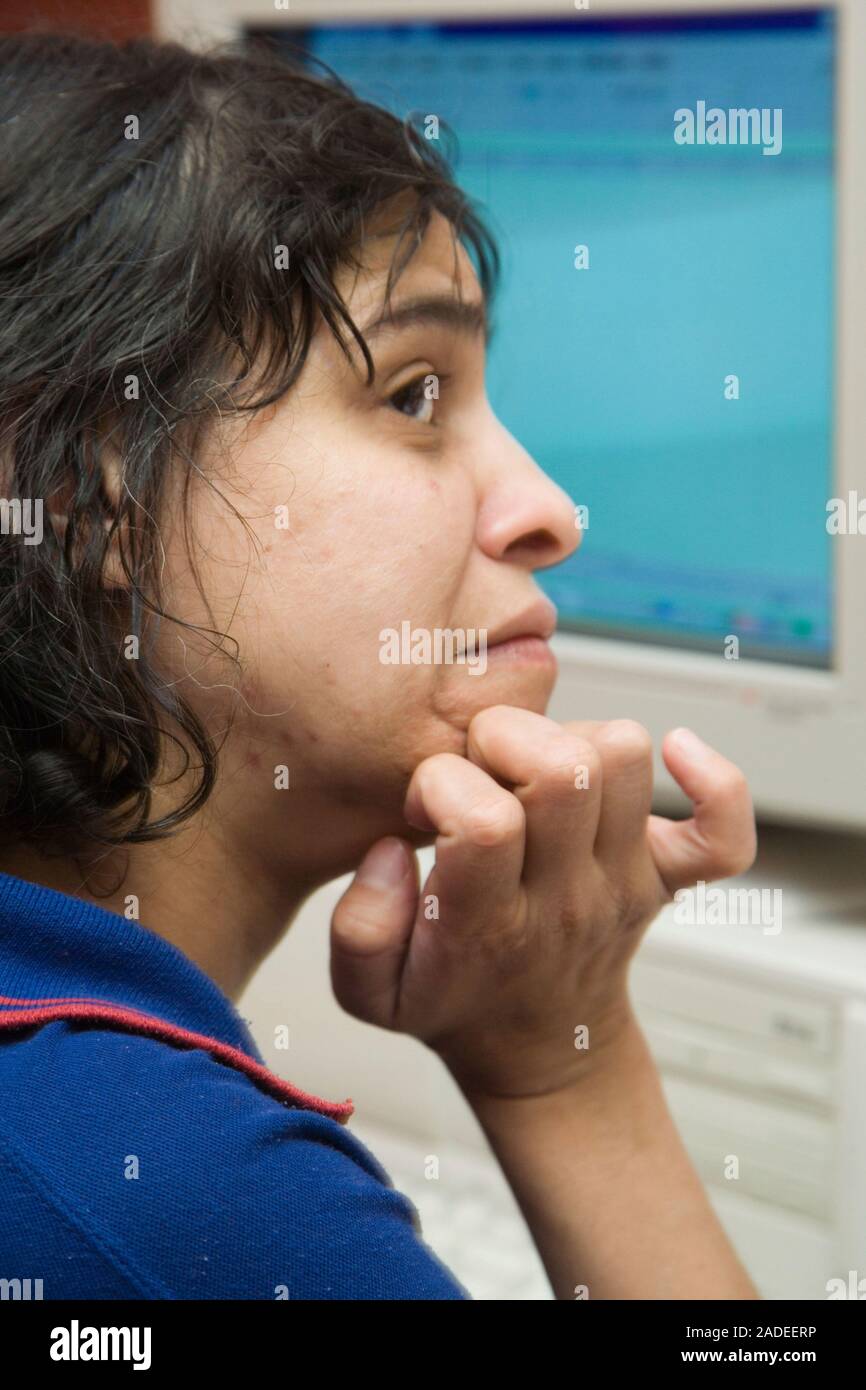 Disabled female meetings representative at work on a computer, thinking ...