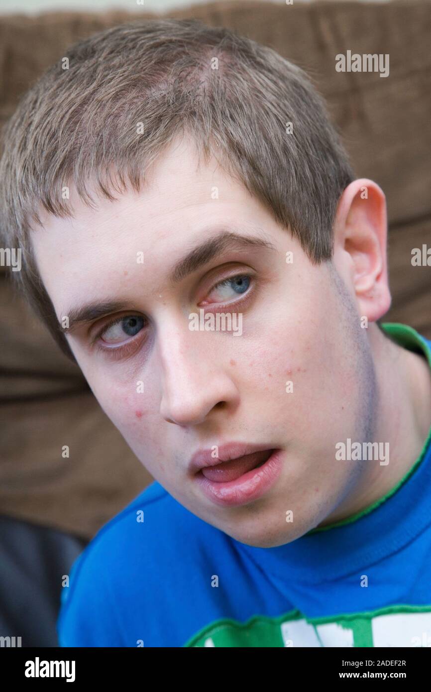 Portrait of teenage boy with autism, looking thoughtful Stock Photo - Alamy