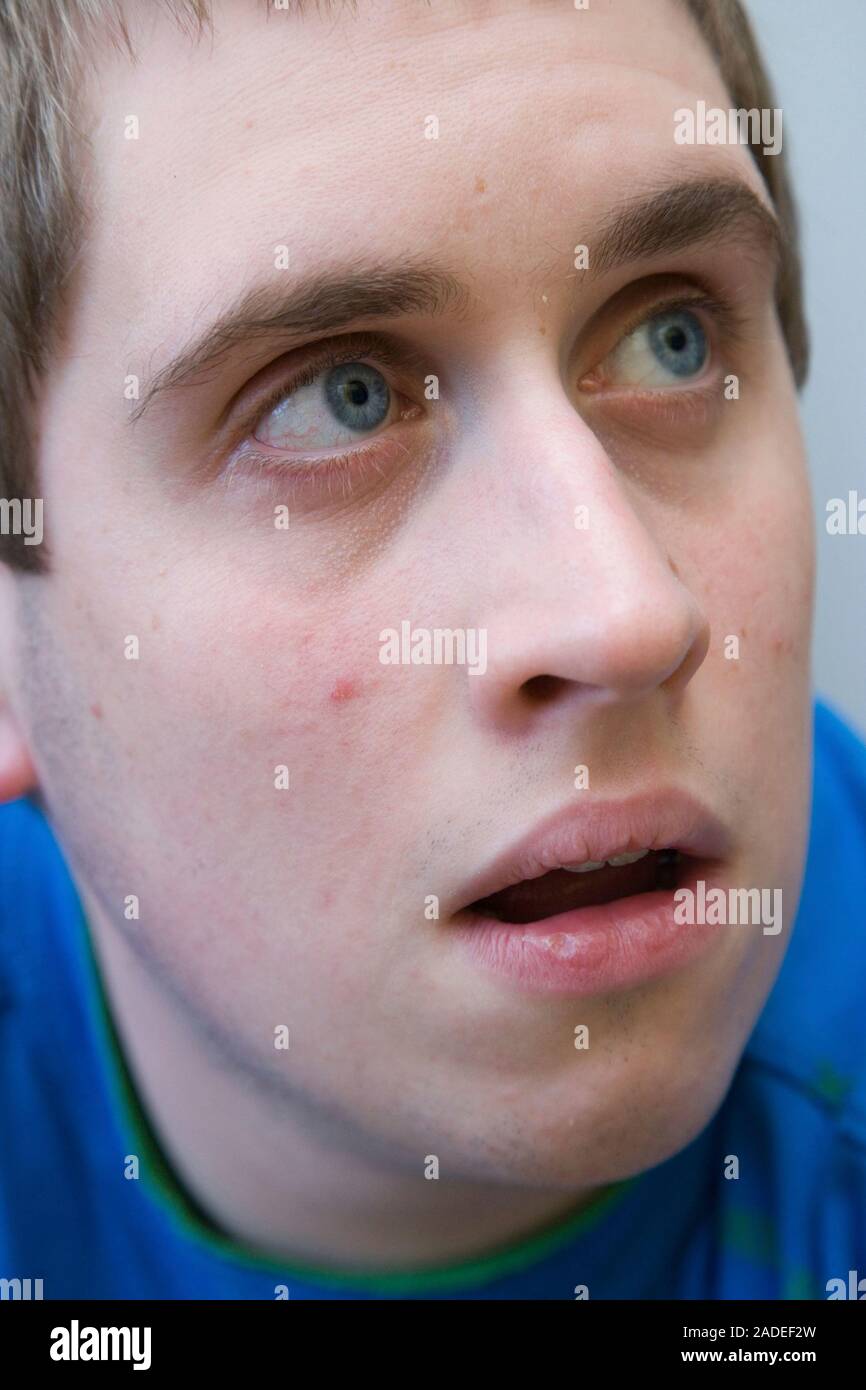 Portrait of teenage boy with autism, looking thoughtful Stock Photo - Alamy
