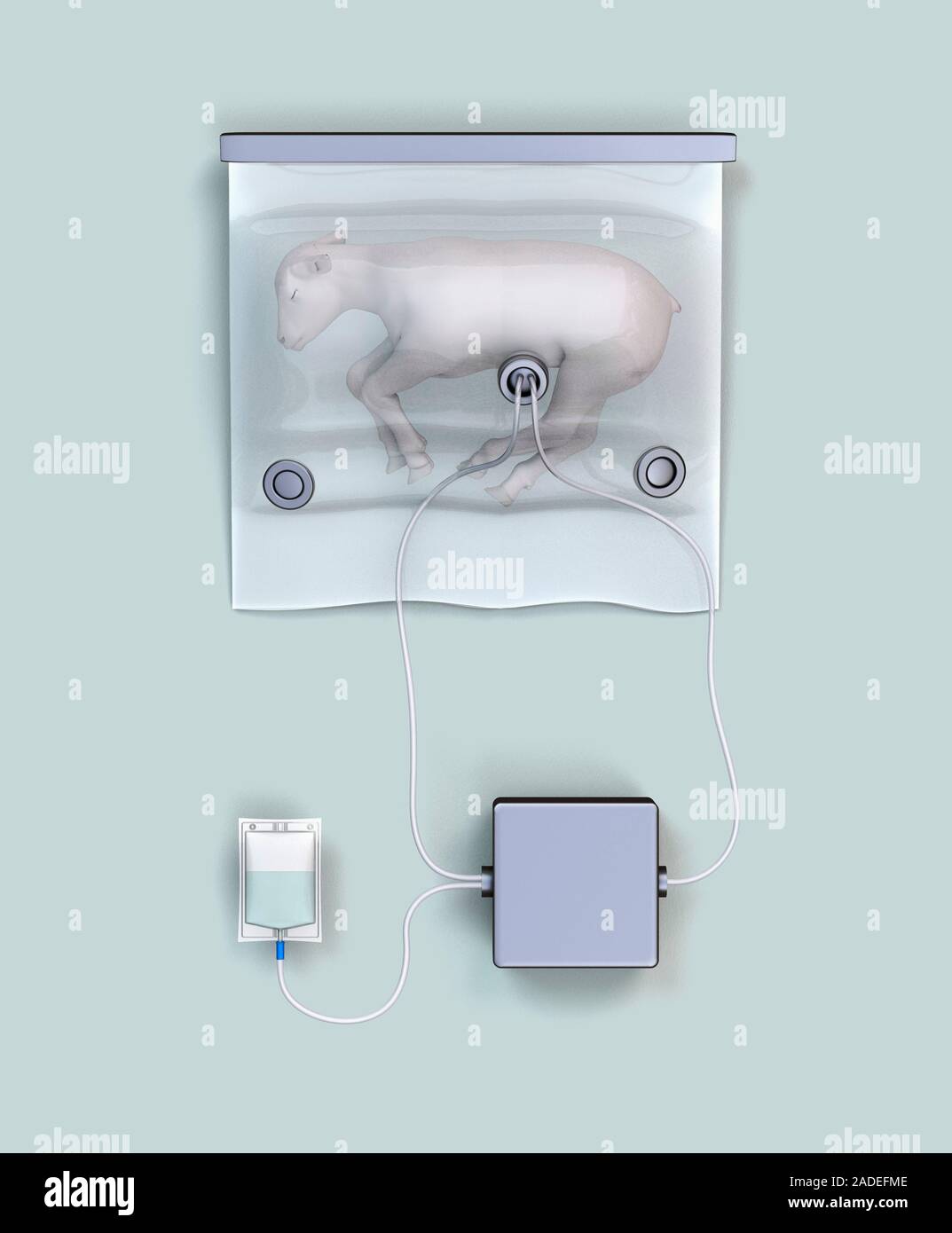 Artificial uterus. Illustration showing an artificial uterus allowing a ...