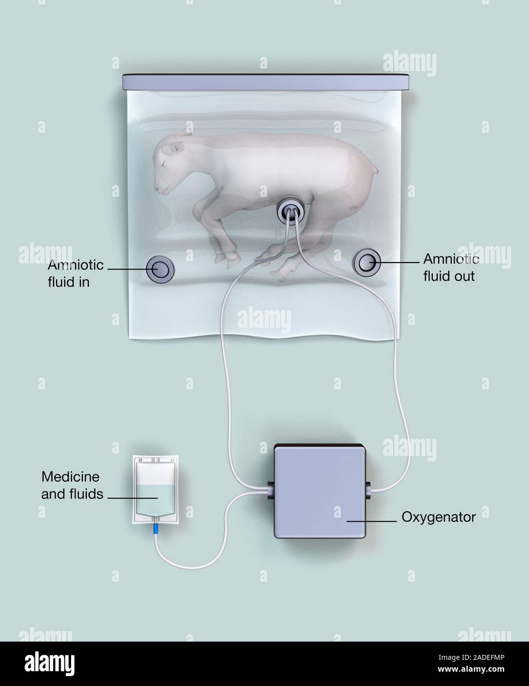 Artificial uterus. Illustration showing an artificial uterus allowing a ...
