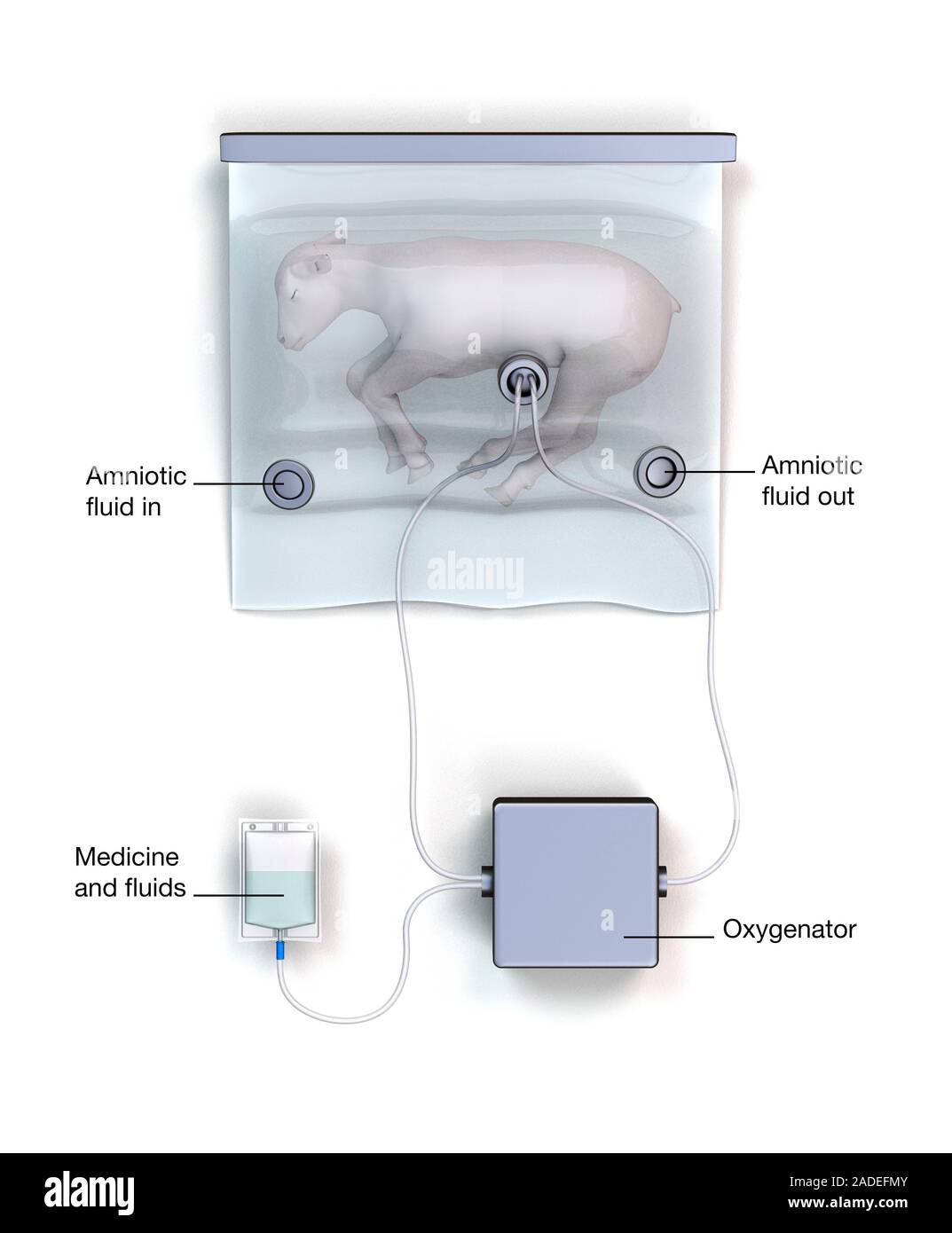 Artificial Uterus Illustration Showing An Artificial Uterus Allowing A Foetal Lamb To Grow To