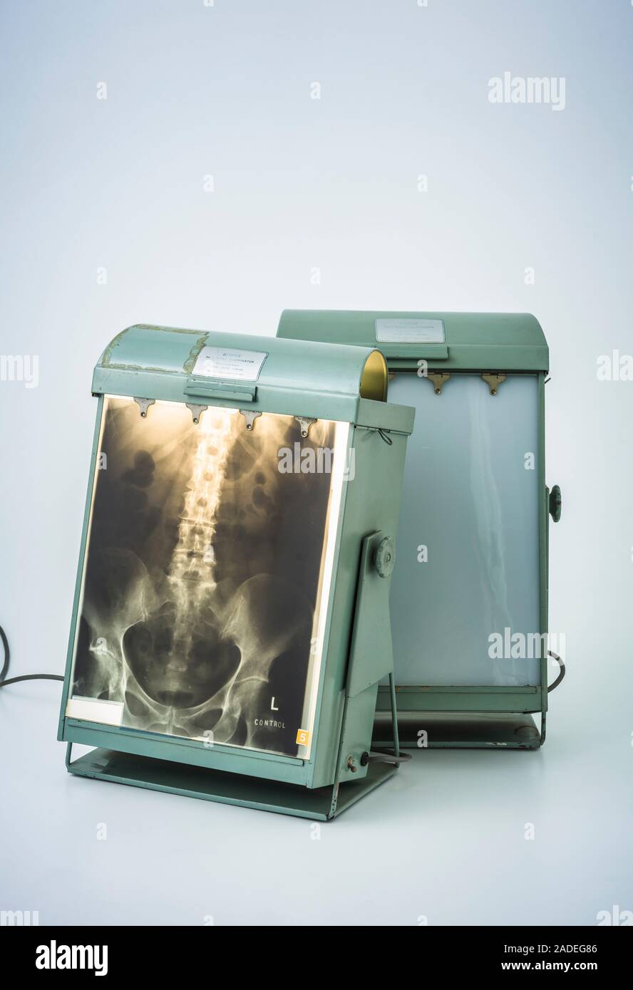 Hospital light boxes for X-rays, 20th century Stock Photo - Alamy