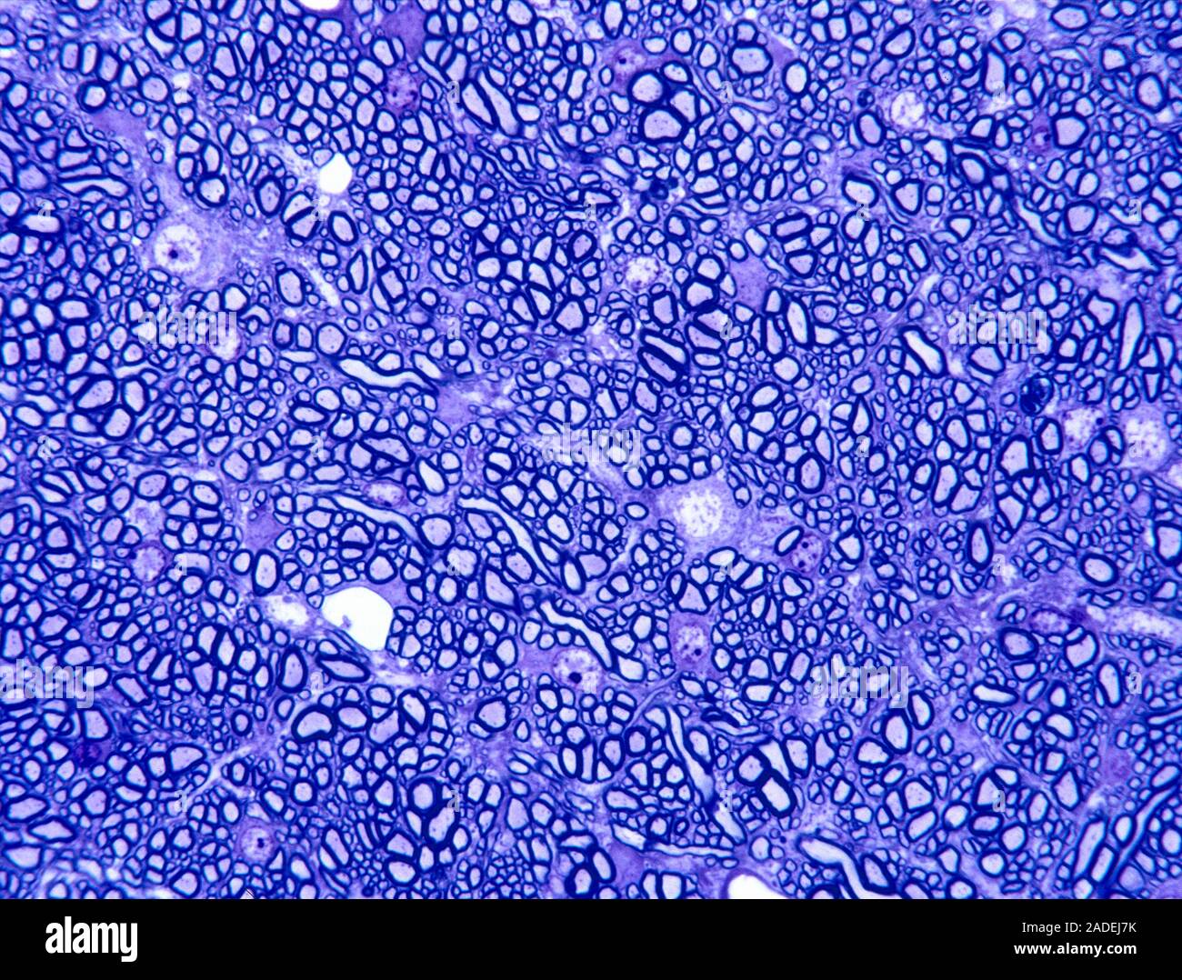 Light microscopy of the white matter of the human brain showing many ...
