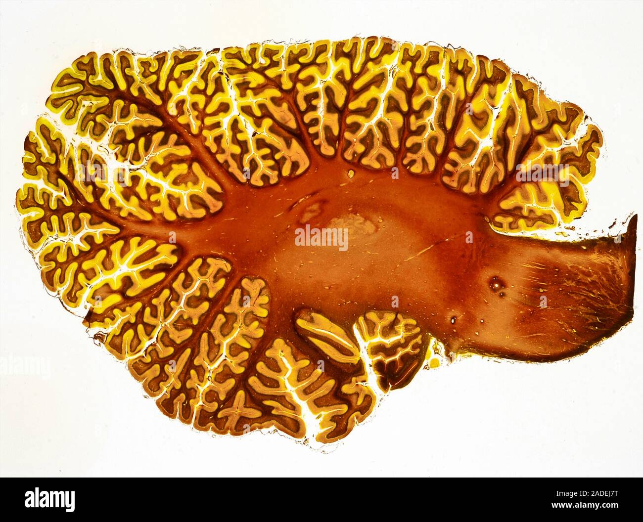 Light microscopy of a primate cerebellum. This organ has a highly ...
