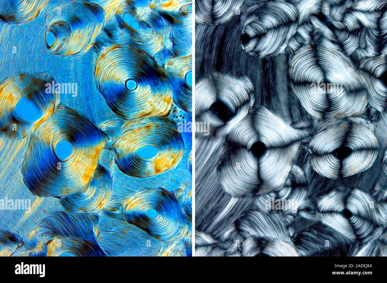 Light micrographs of adult human bone tissue. This sample is an ...