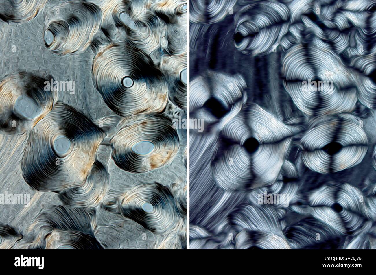 Light micrographs of adult human bone tissue. This sample is an ...