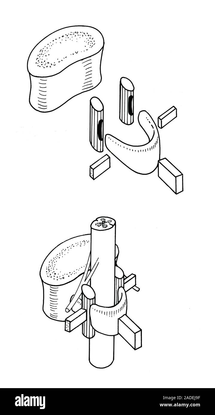 Anatomy of the bony parts of a deconstructed and intact vertebral body ...