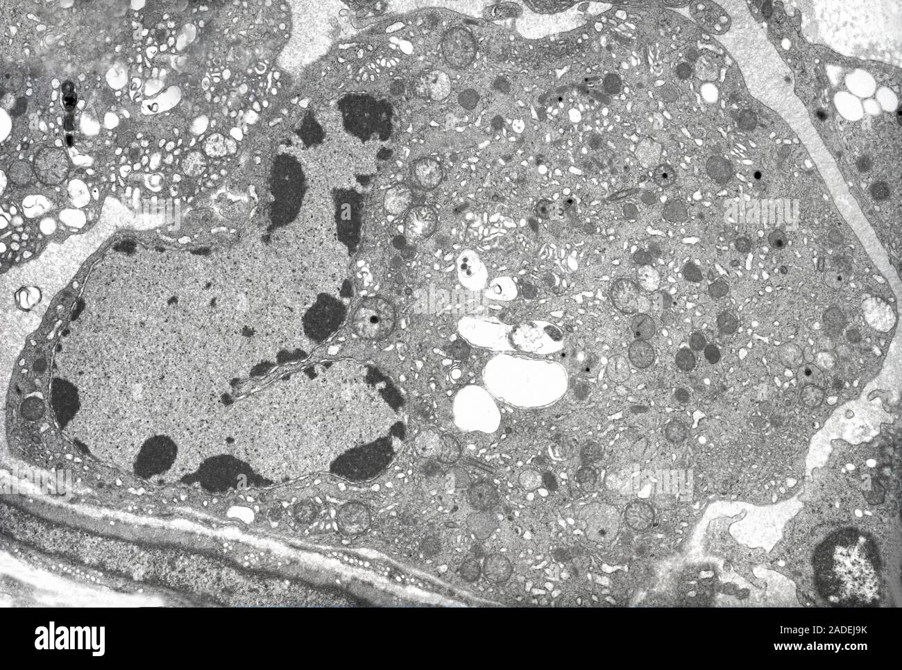 Transmission Electron Micrograph Tem Of The Ultrastructure Of The