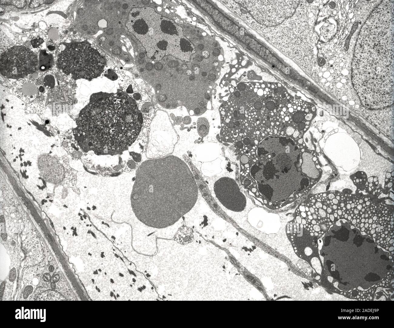 Transmission Electron Micrograph Tem Of The Ultrastructure Of