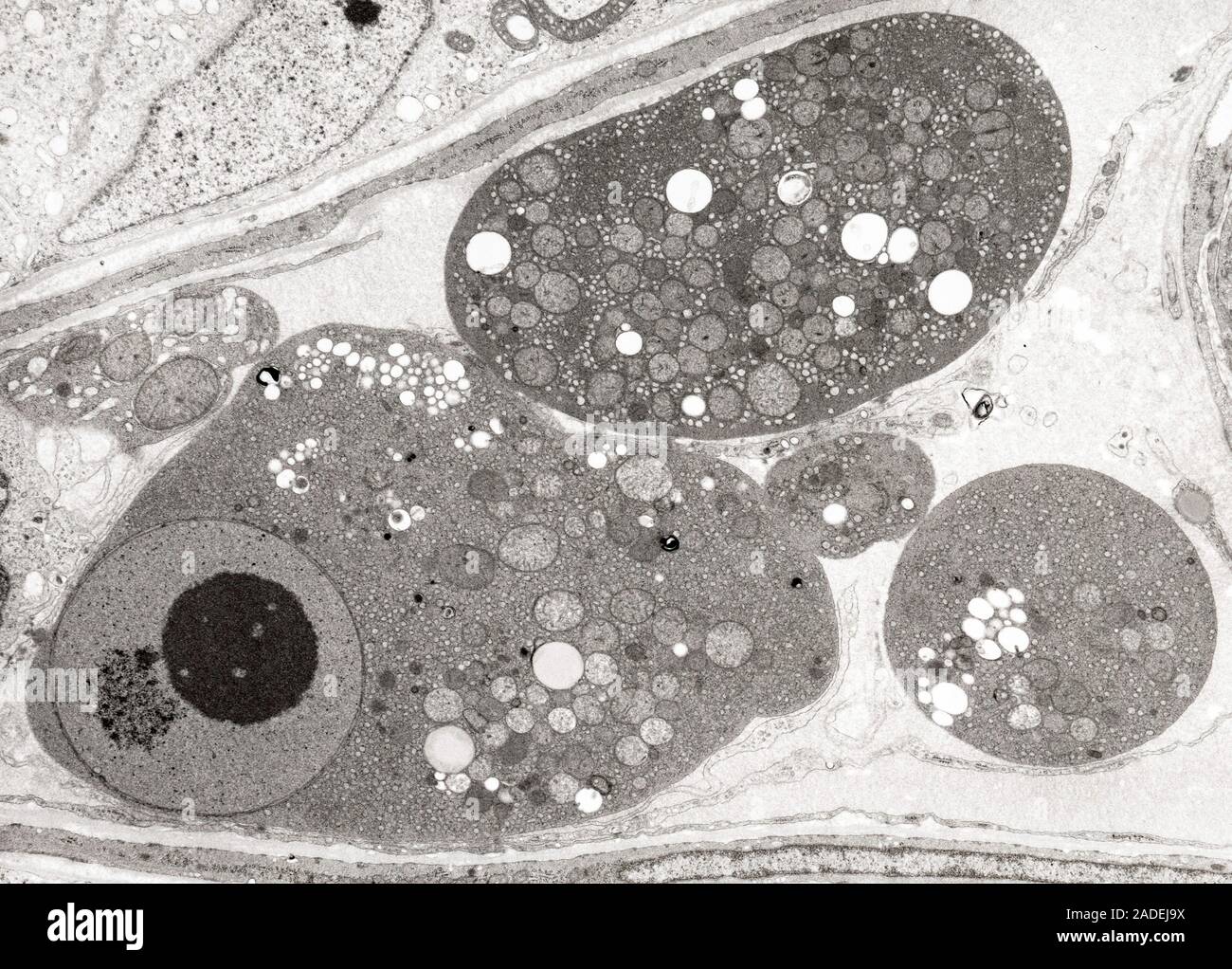 Transmission Electron Micrograph Tem Of The Ultrastructure Of The