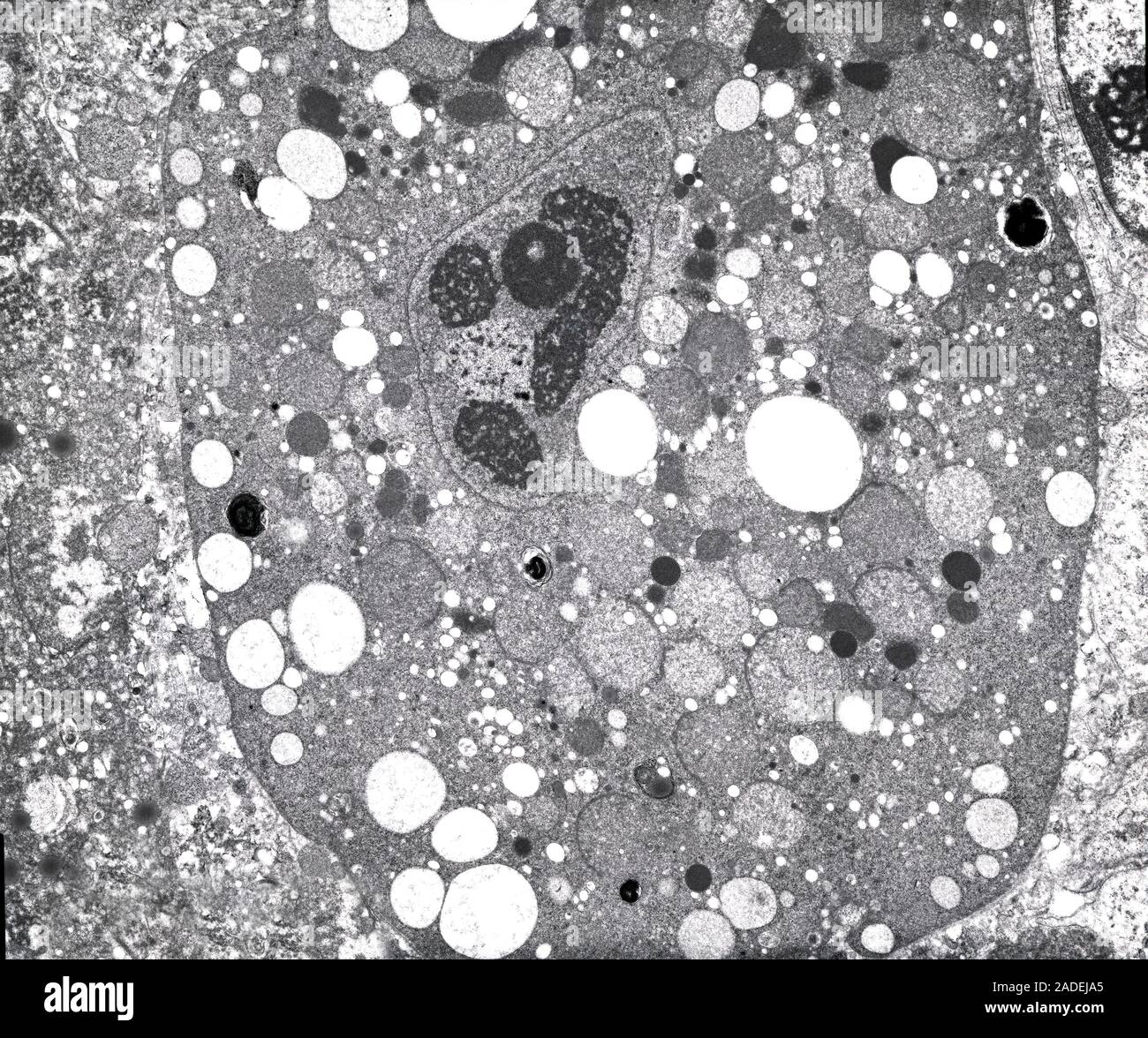 Transmission Electron Micrograph Tem Of The Ultrastructure Of The
