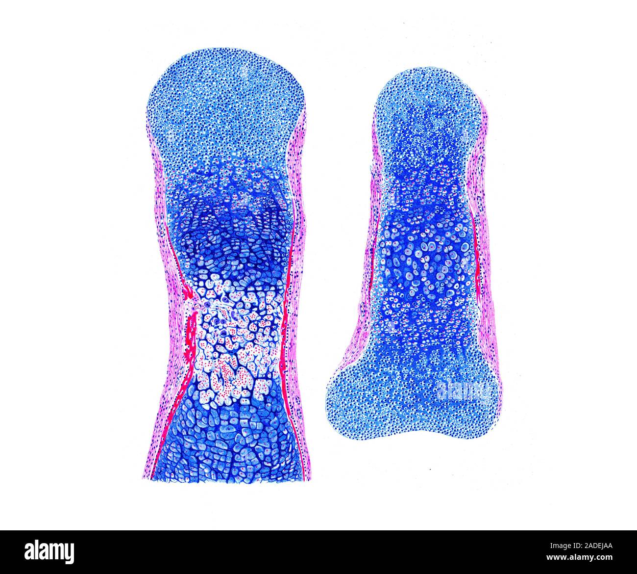 Artwork of the histology of bone development in fingers of a 3 month ...
