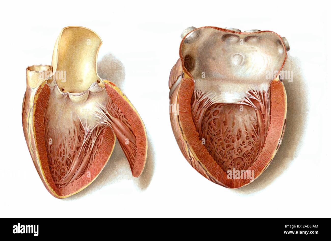 Heart ventricle, illustration. The left ventricle has been opened to ...
