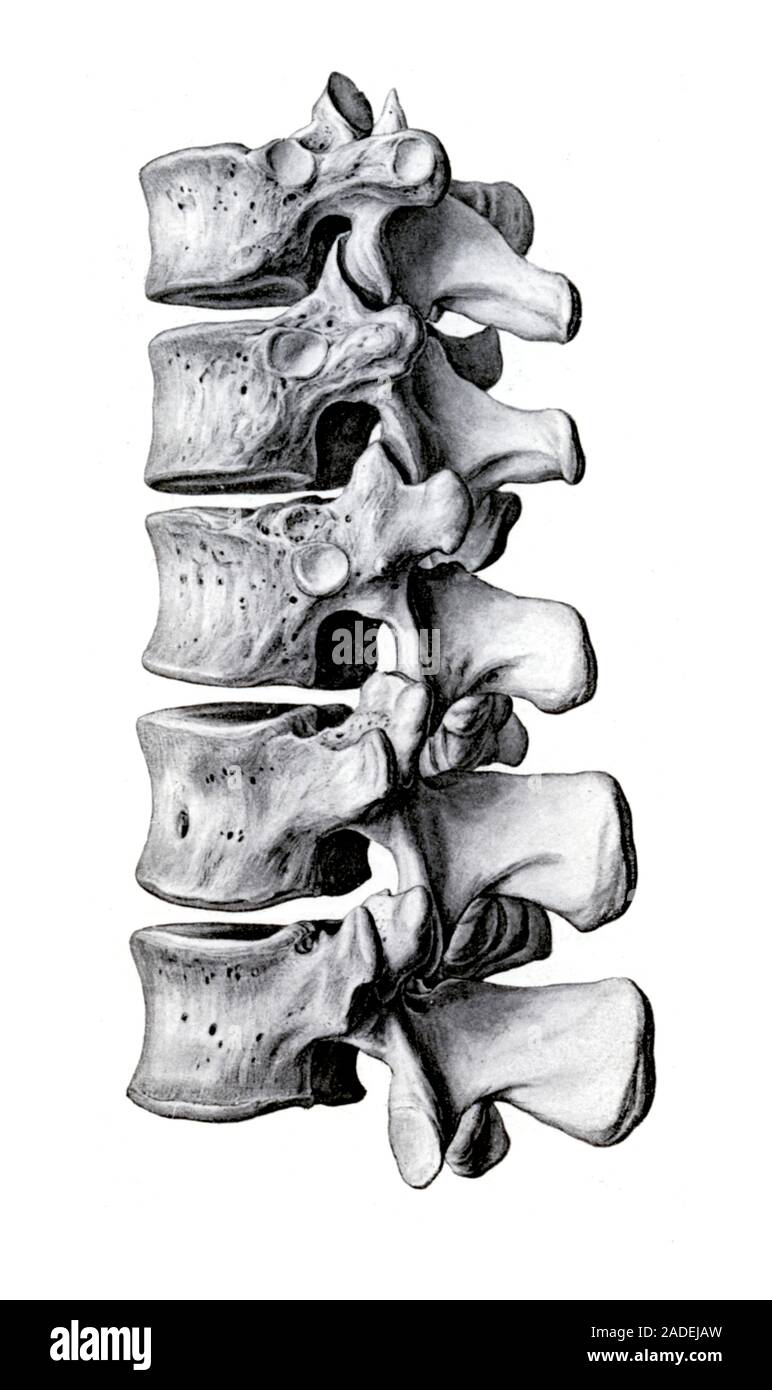 Illustration of thoracic and lumbar vertebral bodies. The 10th -12th ...