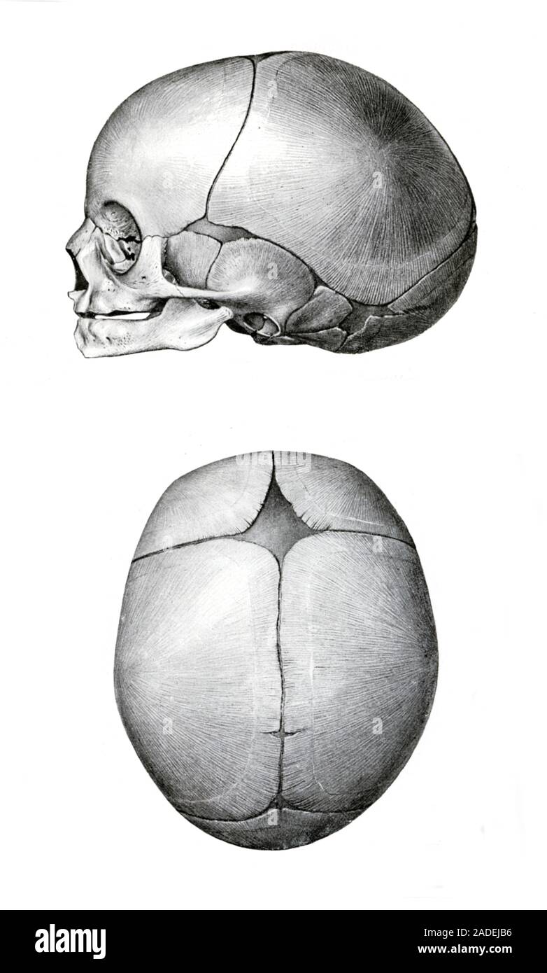 Illustrations of the skull of the newborn child showing sutures or gaps ...