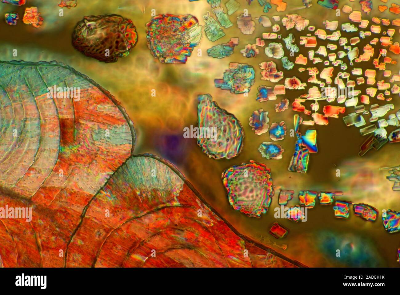 Vitamin B3 crystals, polarised light micrograph. Vitamin B3 exists in ...