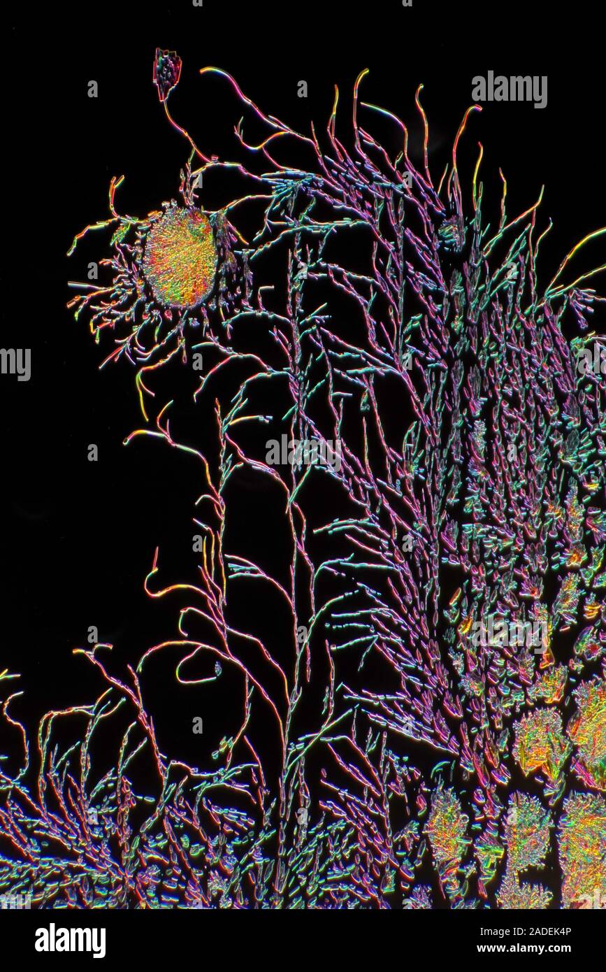 Vitamin B3 crystals, polarised light micrograph. Vitamin B3 exists in ...