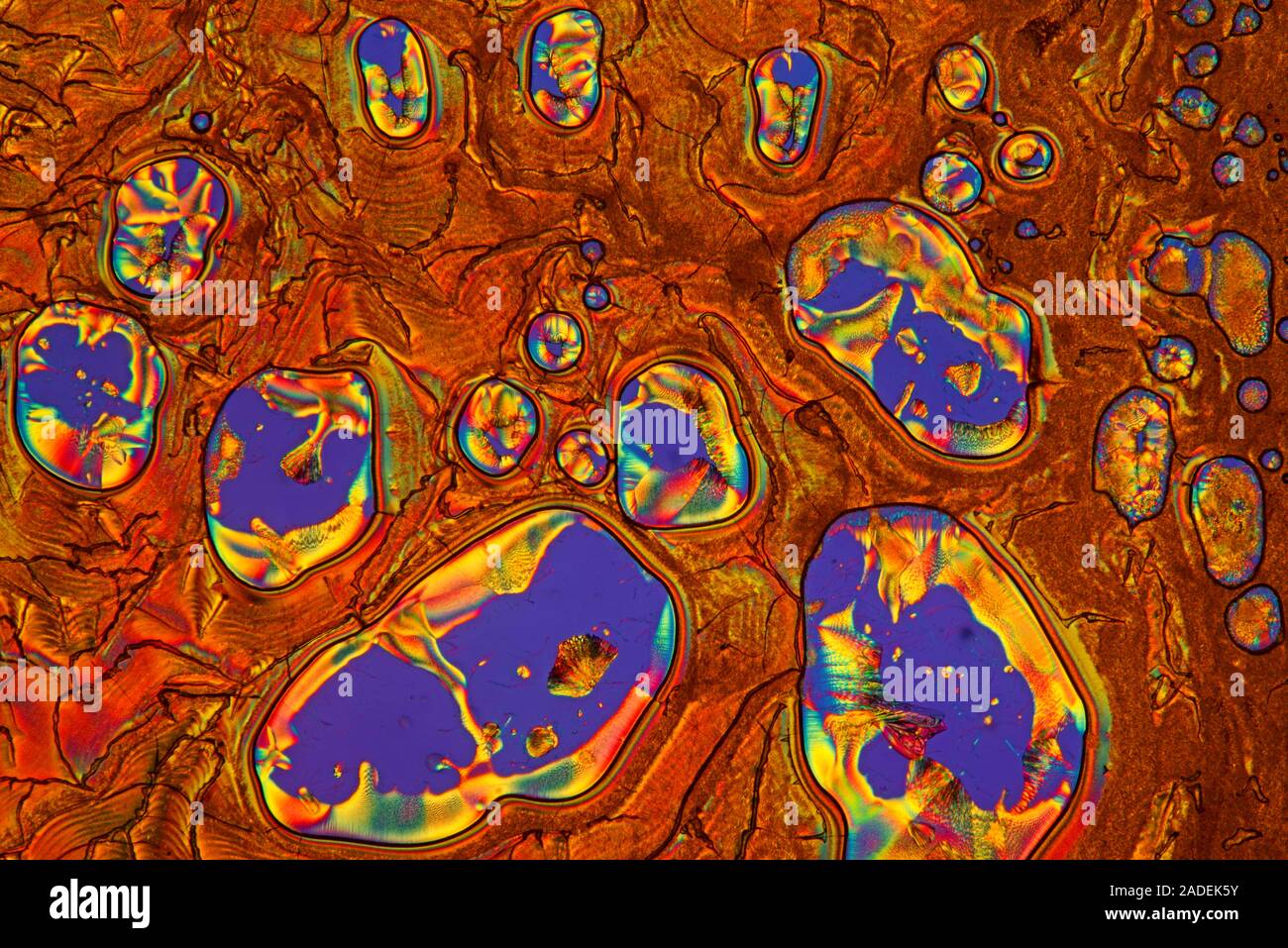 Vitamin C crystals. Polarized light micrograph of crystals of vitamin C ...